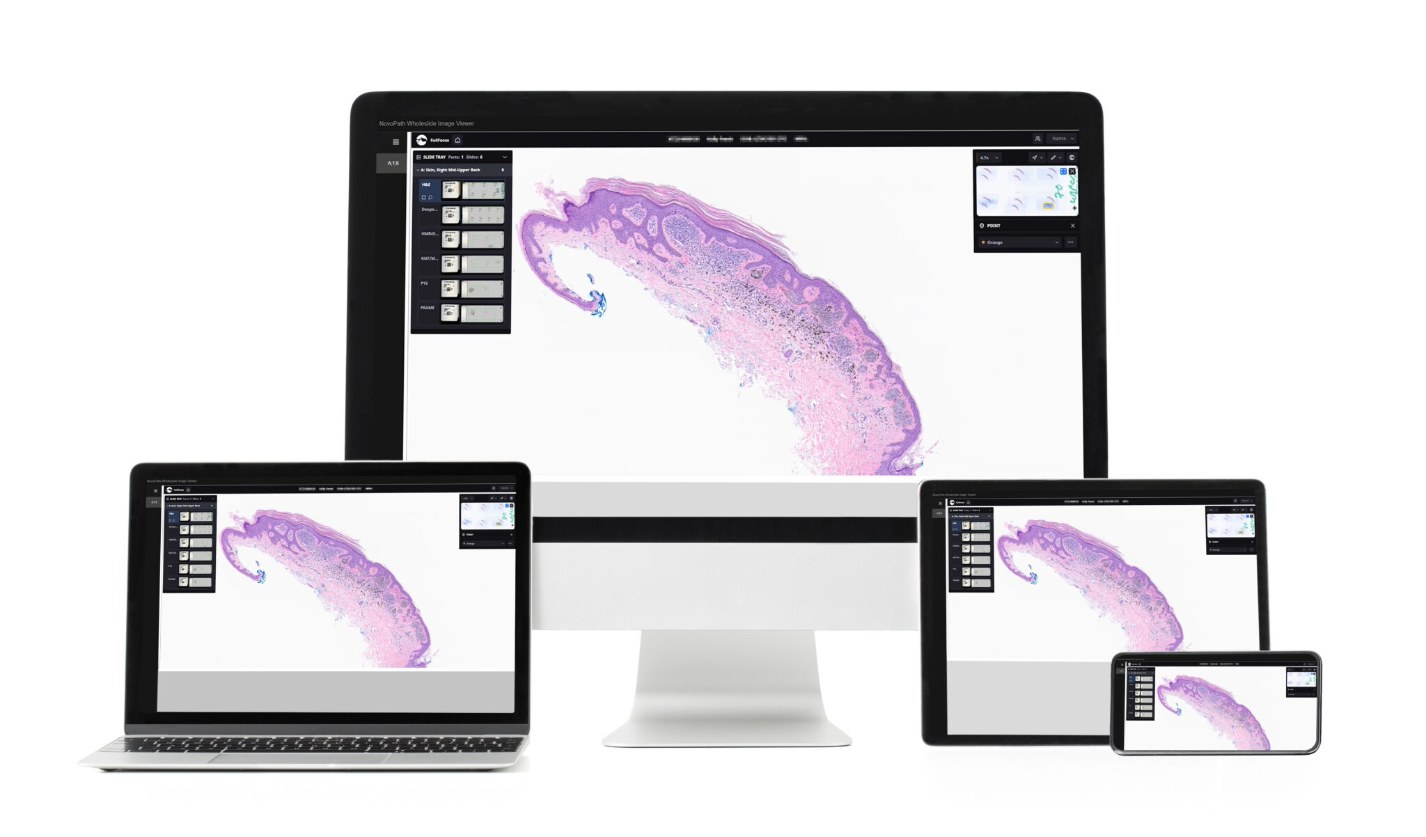 Digital Pathology - Inform Diagnostics